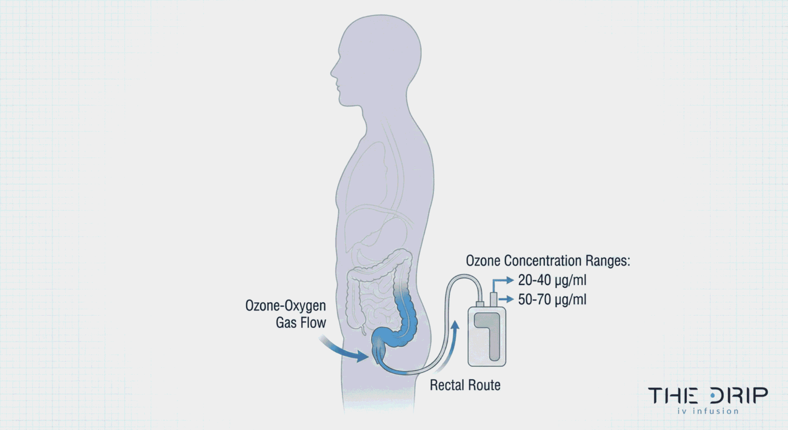 How Is Ozone Therapy Administered?