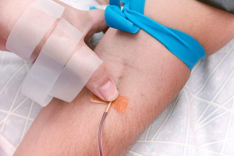 IV Insertion Tips